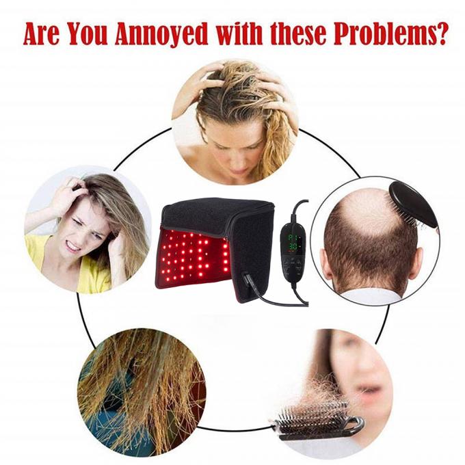 LED SMD Red Light Therapy Helmet Hair Growth Lightweight For Hair Loss